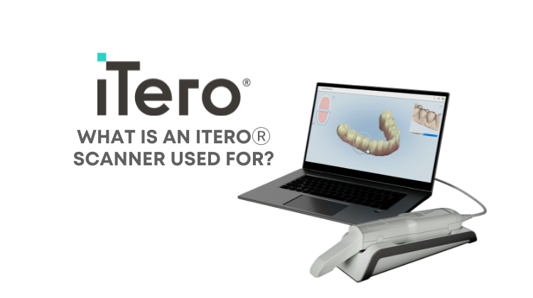What Is An Itero® Scanner Used For